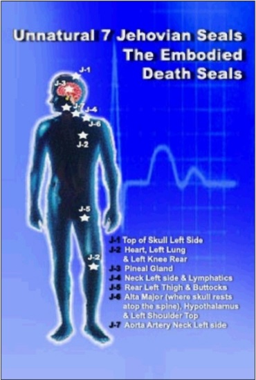 Jseals & Implant Removal Session – quantumscribe